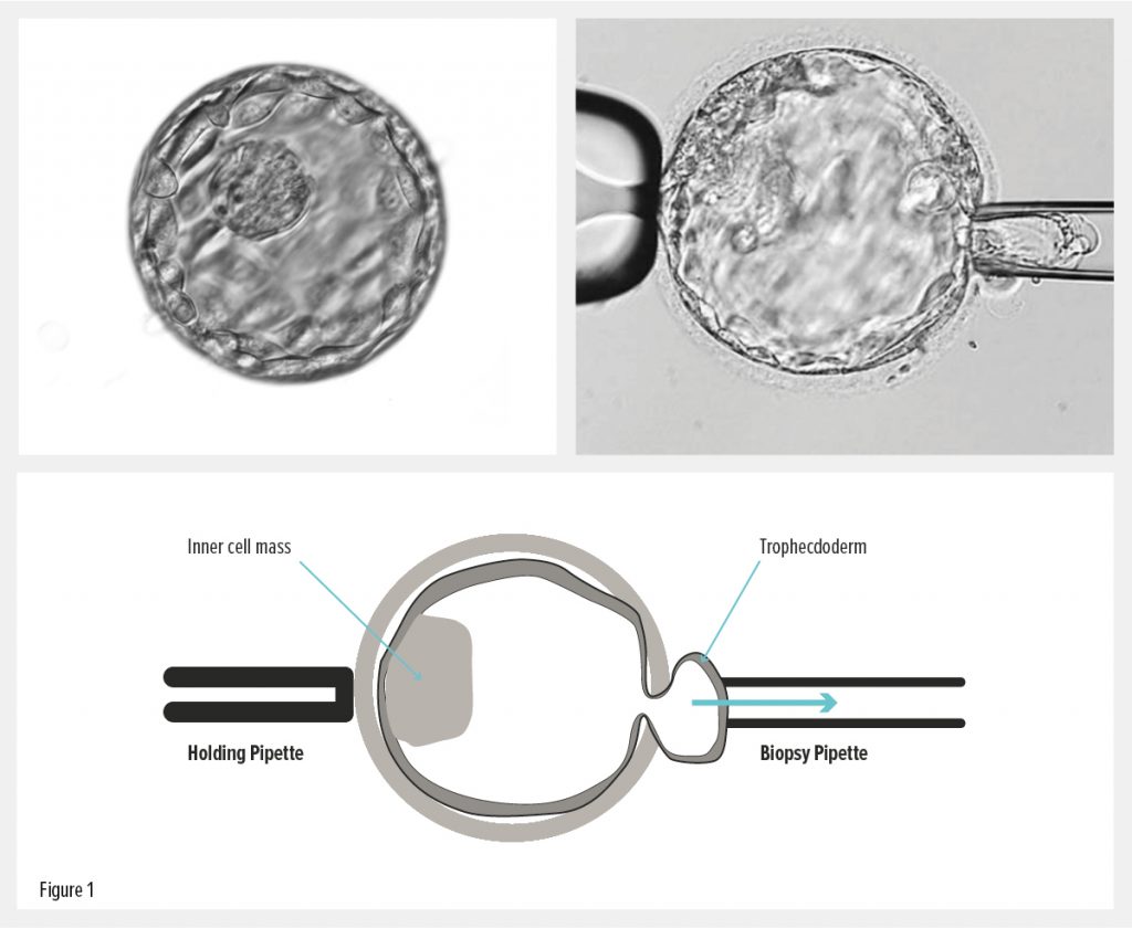 Pre-implantation-diagram-fig1-desktop | Life Fertility Clinic